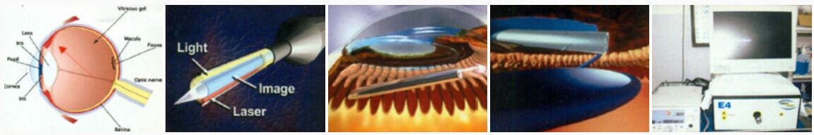 What’s New - Sharnam Eye and Laser Services